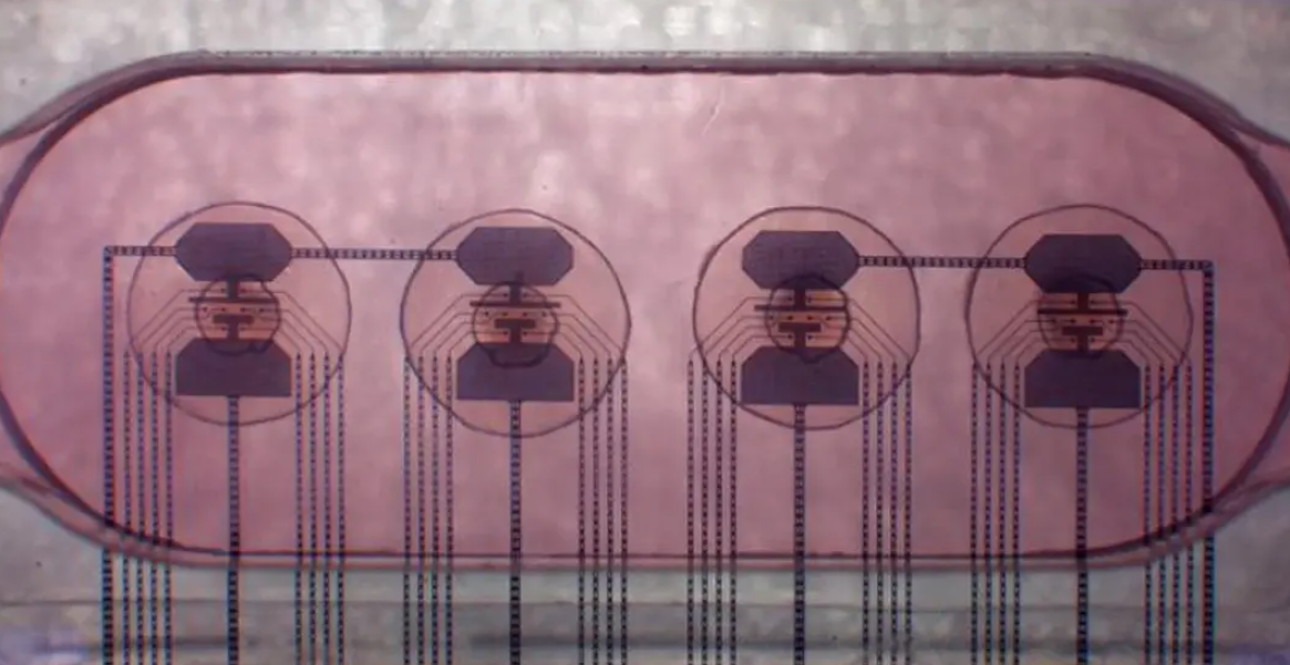 Scientists Connect 16 Mini Brains to Create a "Living Computer"